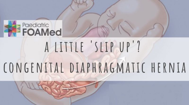 A little ‘slip up’… Congenital Diaphragmatic Hernia – PaediatricFOAM